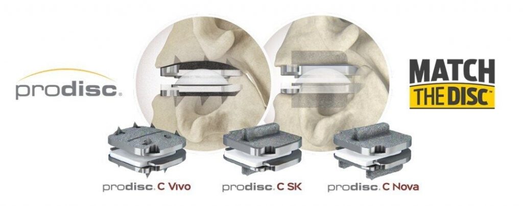 Over 10,000 Procedures Completed in U.S. with Centinel Spine's Match ...