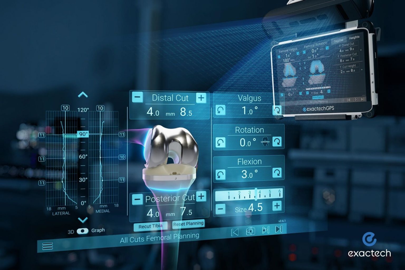 New Study Demonstrates Superior Reproducibility Using Exactech Knee ...